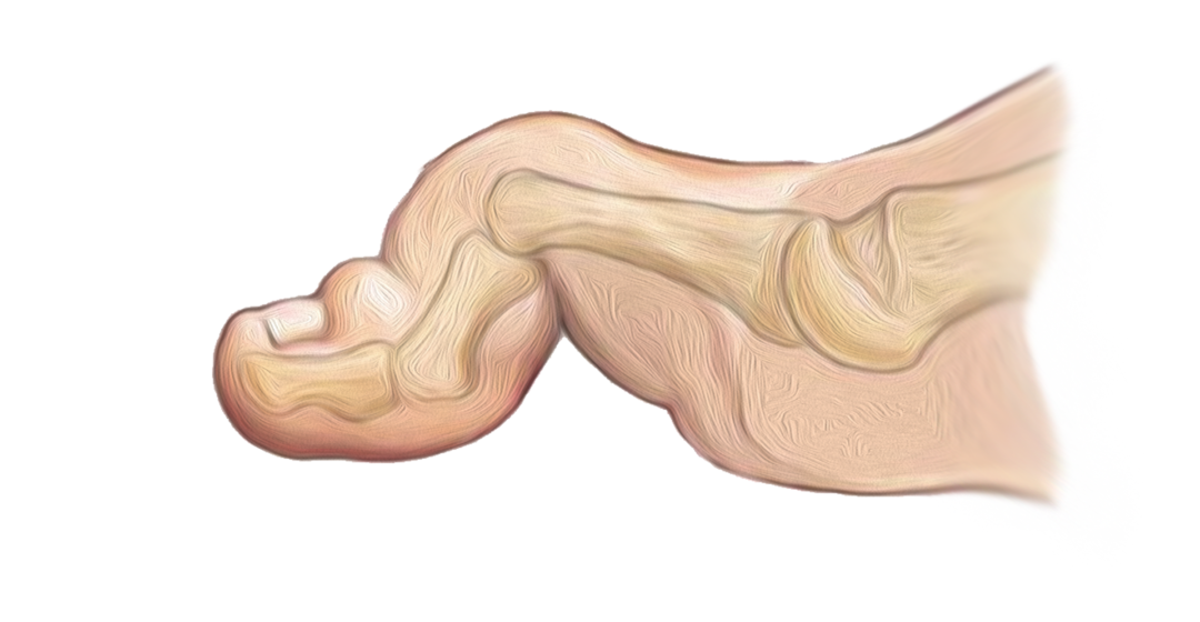 Patient Education | High Desert Foot & Ankle Specialist